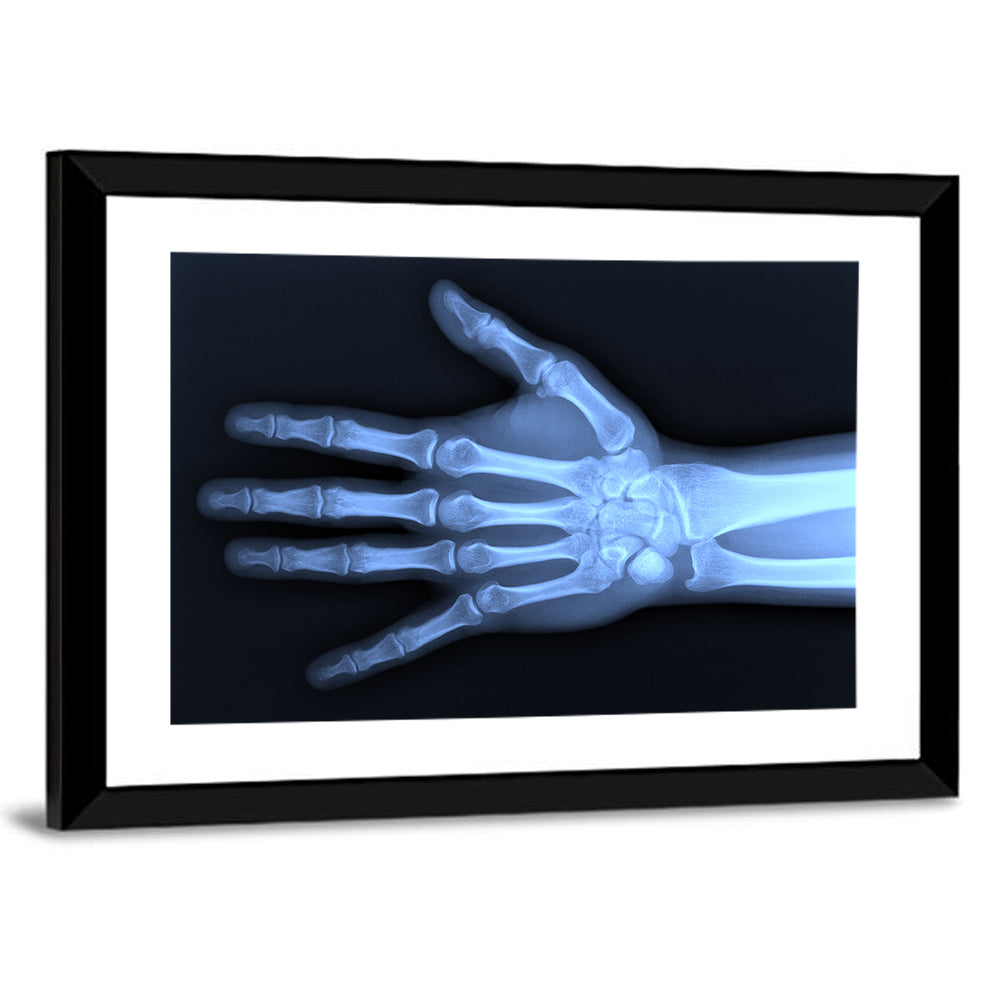 Hand X-Ray Wall Art – CanvasPiece